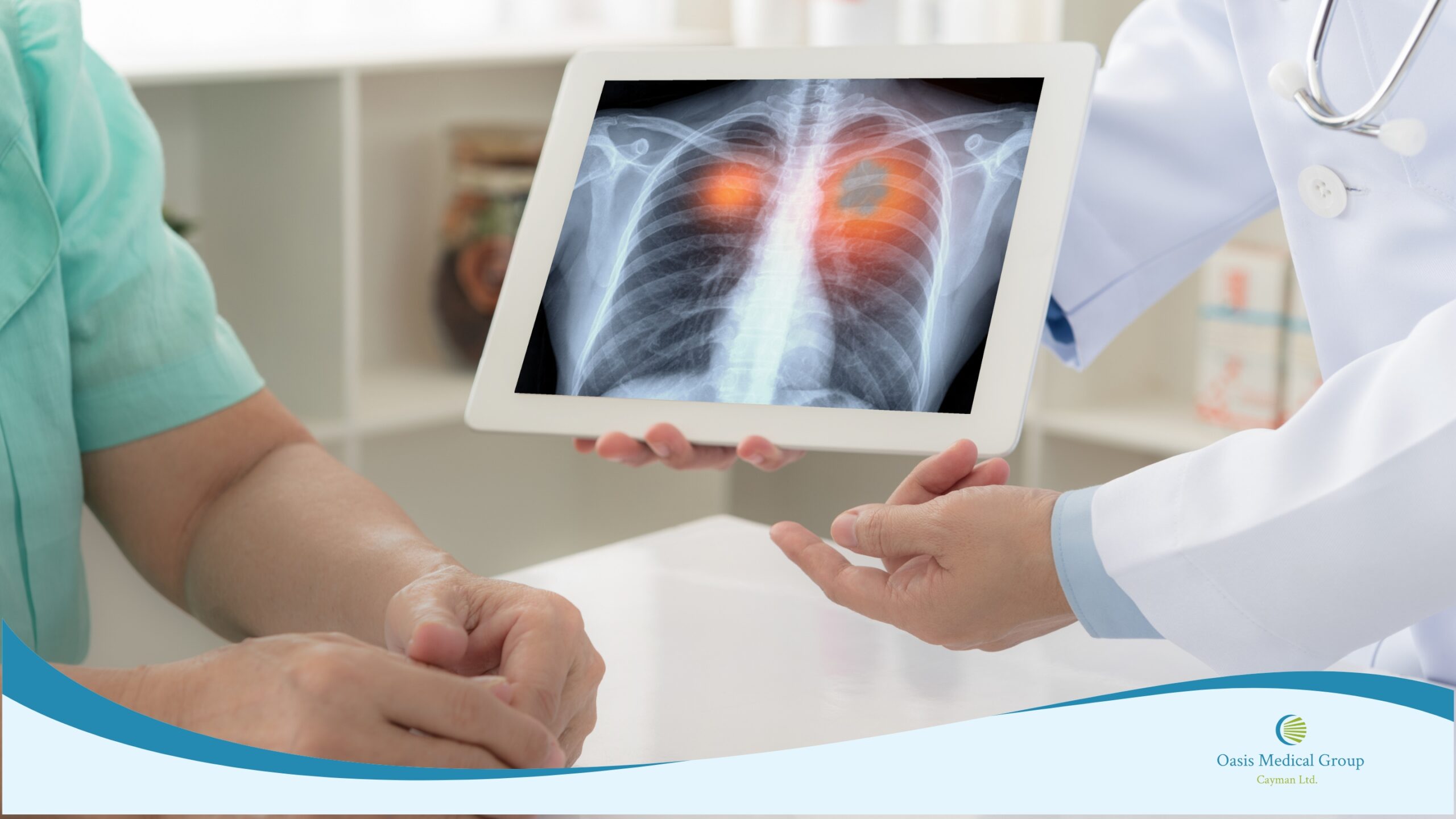 Beating Lung Cancer: Your Guide to Better Lungs - Oasis Medical Group